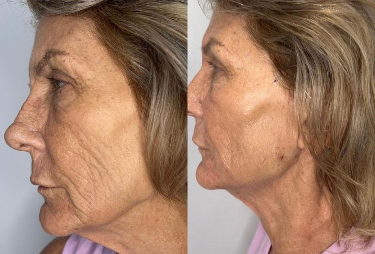 April Specials with Scottsdale Skin and Holistic Health